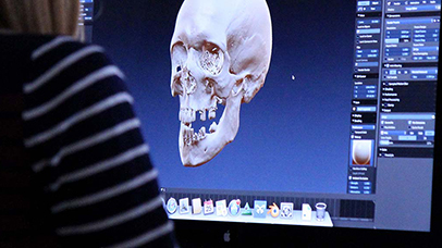International recognition for world-first virtual autopsy courses ...
