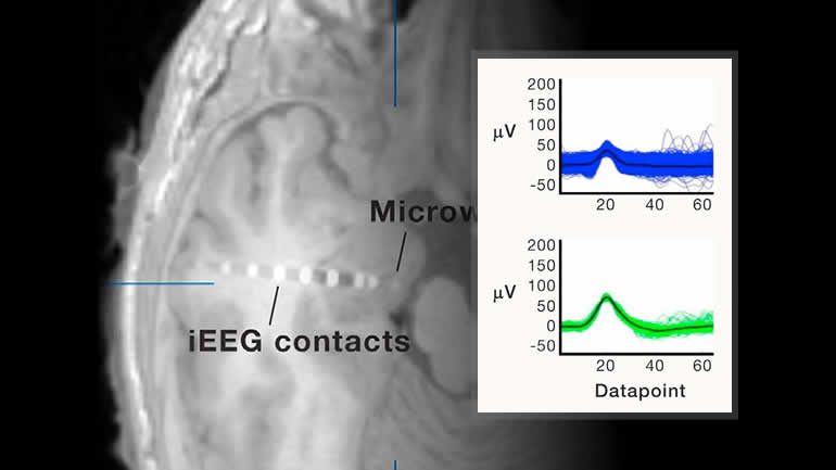 Groundbreaking research identifies what makes human brains – and humans ...