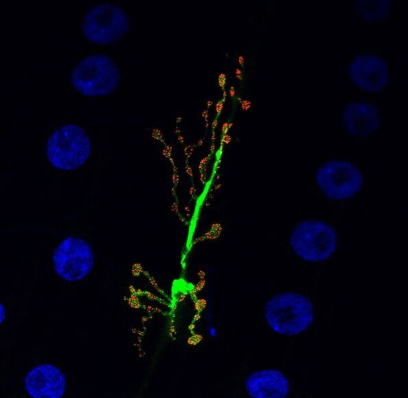Scientists unraveling the mosaic of the human brain | News | University ...
